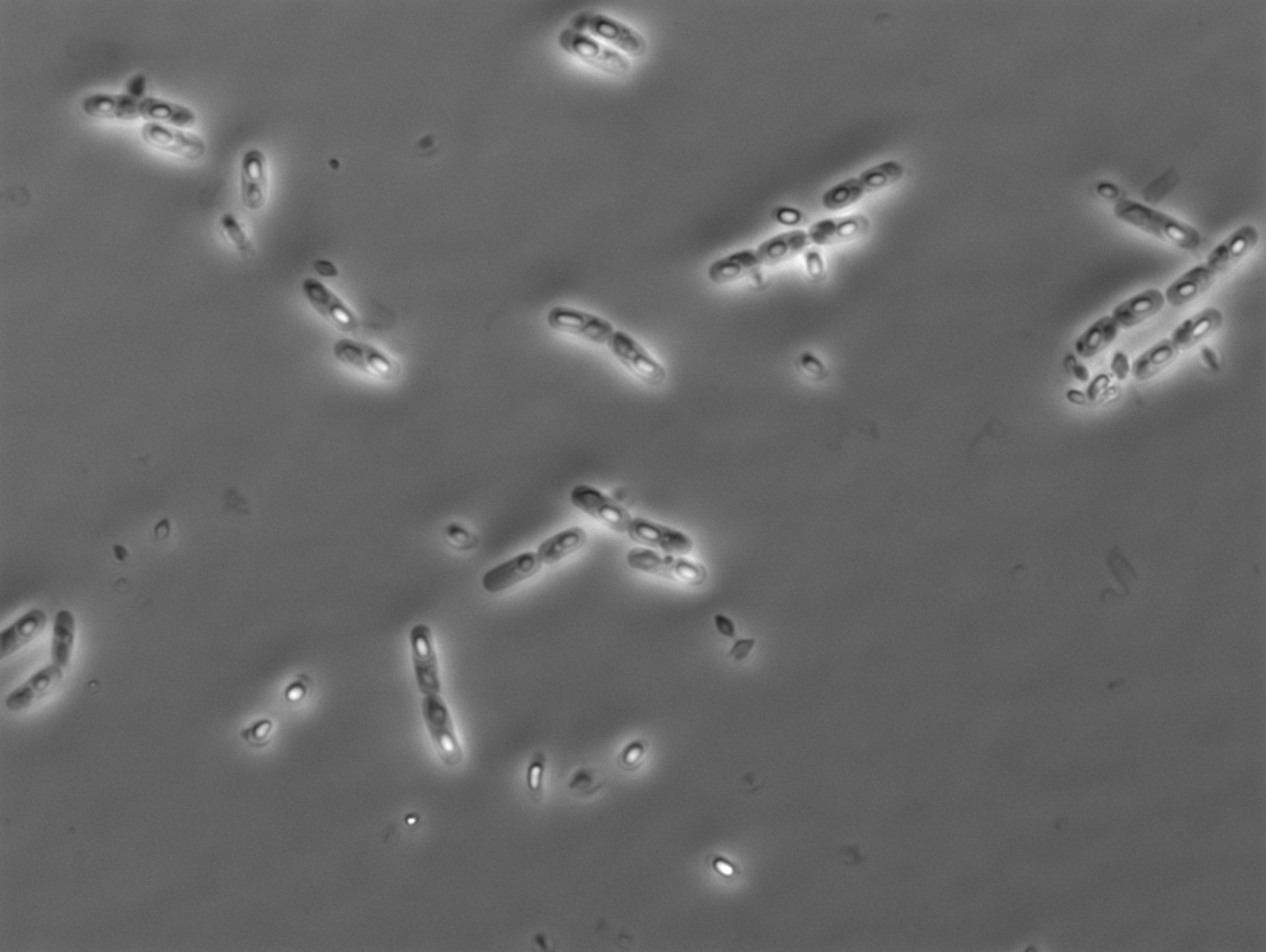 Caractérisation des isolat de Bacillus Cereus - ADRIA